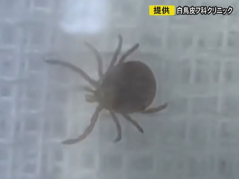 マダニ通じて感染し“人⇔ペット”も…感染症『SFTS』に飼い主も戦々恐々 人の場合は致死率最大3割近く (東海テレビ) - Yahoo!ニュース